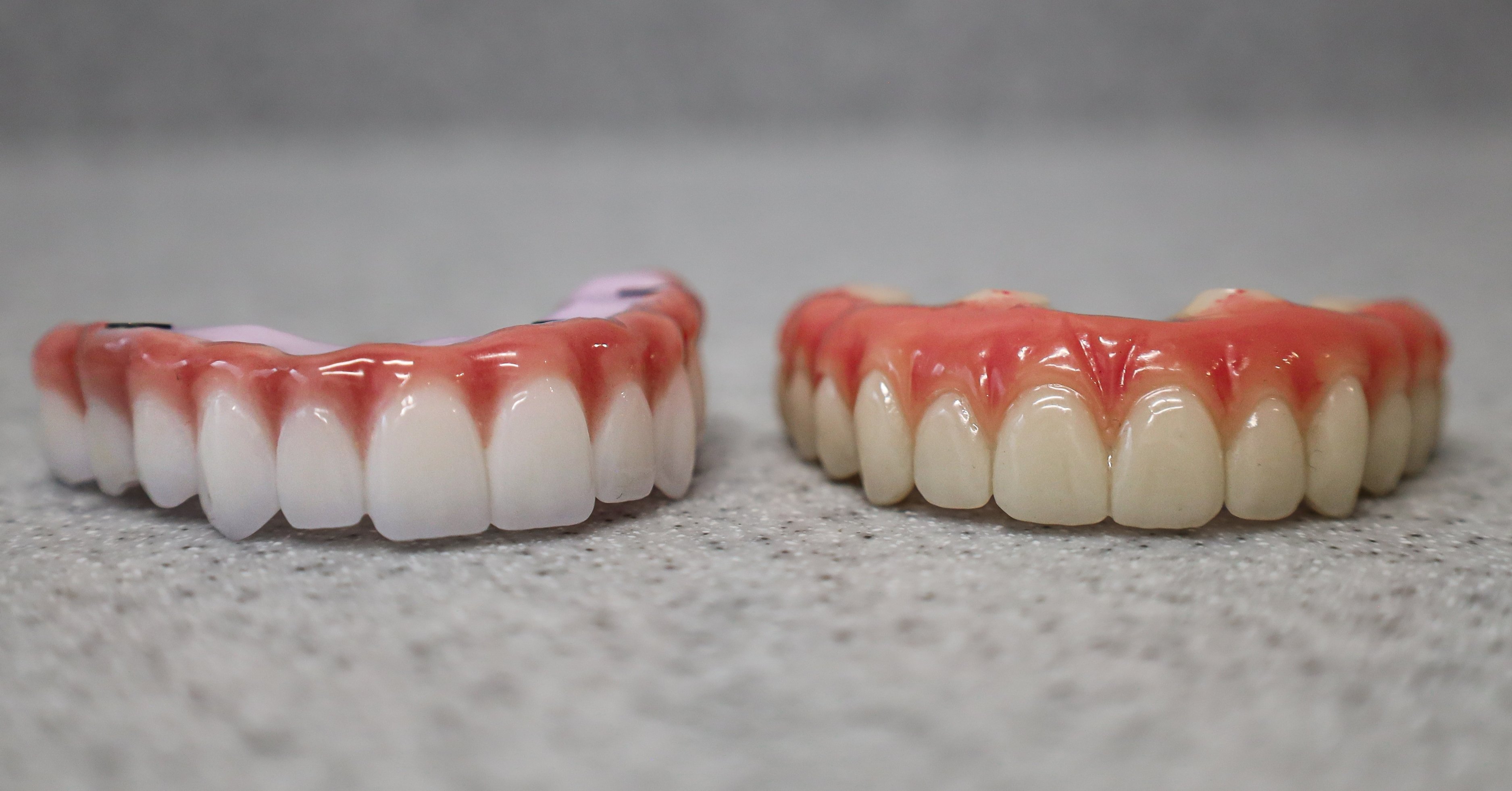 Zirconia vs. Acrylic Teeth: Which Is Best for Your Dental Implants?